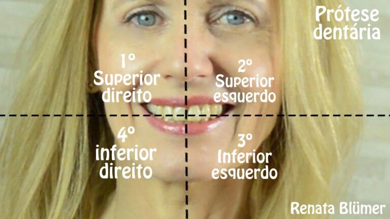 Quadrantes Dentários: Conheça a Importância e Funcionalidade dos Dentes ...